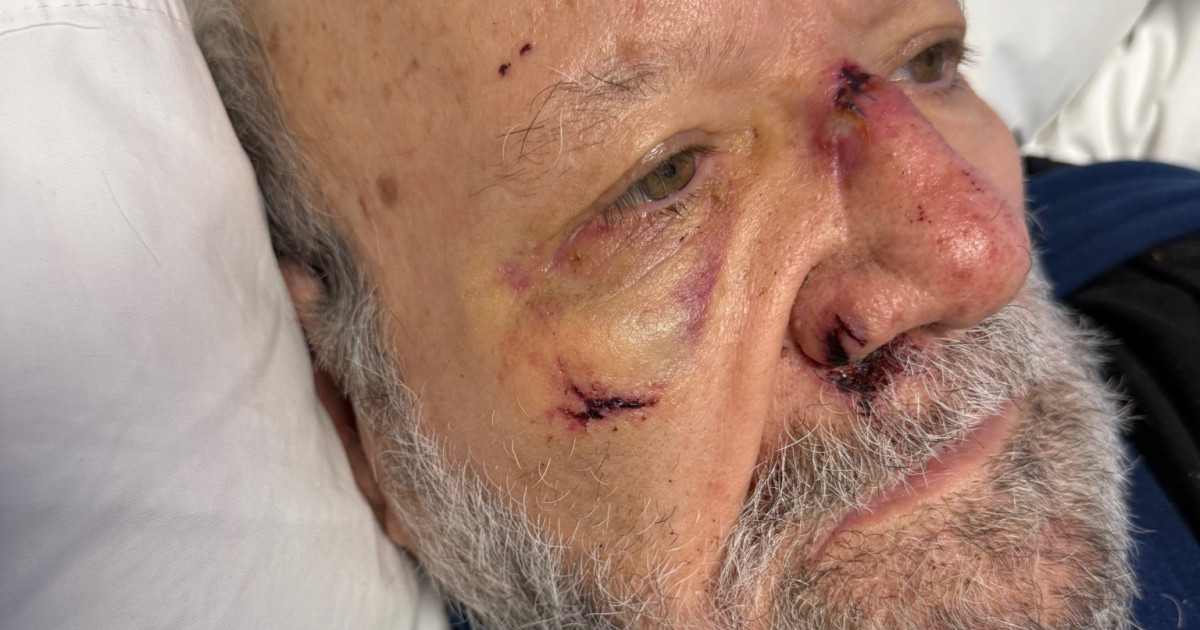 Brutal daylight attack - 79-year-old beaten in Mareeba CBD | The ...